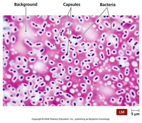 Lab Flashcards Quizlet