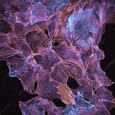 Cultured Cancer Cells Cytoskeleton Light Micrograph Stock Image C048 9527 Science Photo