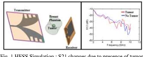 Figure 1 From Microwave Time Reversal Mirror For Breast Tumor Detection Semantic Scholar