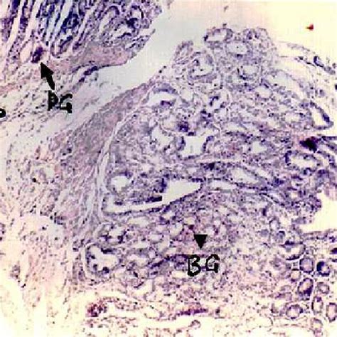 Micrograph Of Duodenum Of Normal Download Scientific Diagram