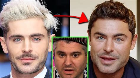 Zac Efrons Plastic Surgery Youtube