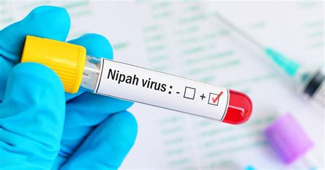 Explained Nipah Virus And Its History In India Explained Nipah Virus And Its History In India