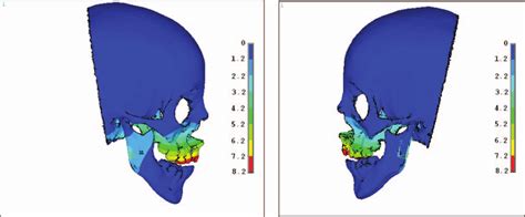 Displacement Lateral View Download Scientific Diagram