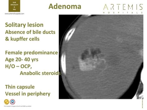 Tpct Triphasic Ct Scan Liver Ppt