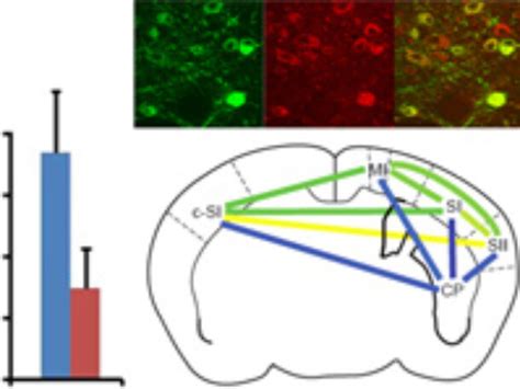 Cell Type Specific Defects In Pten Mutant Cortical Organoids Converge On Abnormal Circuit