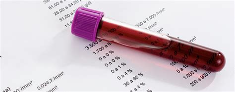 Costo De Un Hemograma Completo Costo Total De Un Hemograma 53 Off