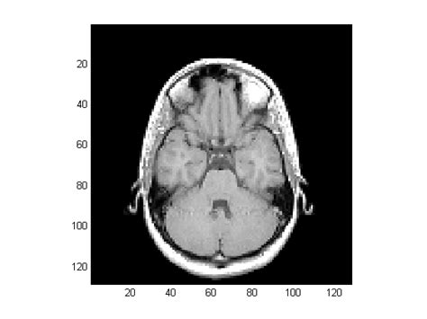 Application Example Viewing Mri Data