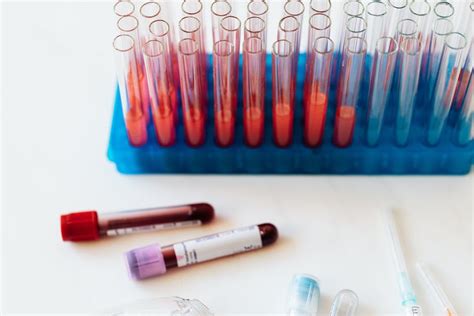 Erfahren Sie Wie Lange Der Pcr Test Gültig Ist Wenn Sie Reisen Hier