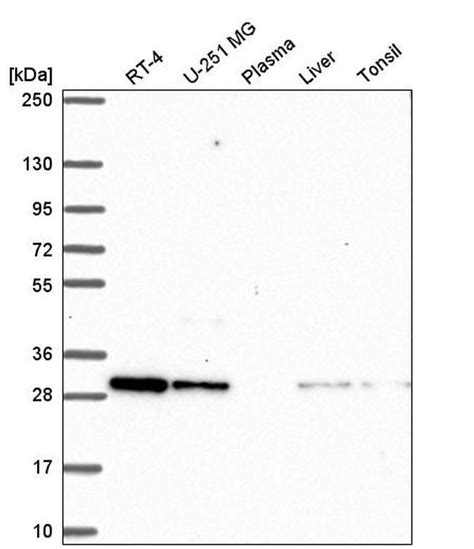 Invitrogen Cxxc5 Polyclonal Antibody 100 μl Unconjugated Antibodies