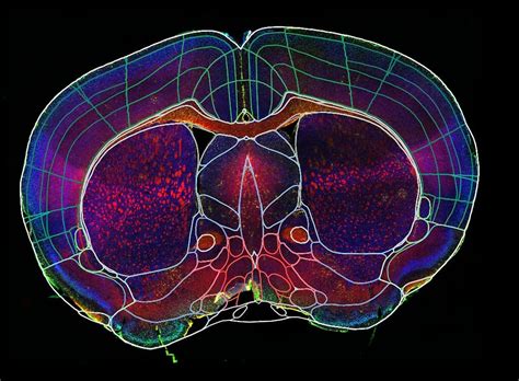 How To Detect 3 Different Types Of Cells In A Qupath Workflow Image