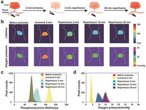A Schematic Illustration For The Hepatic Ischemia‐reperfusion Model