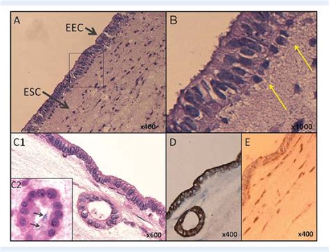 Figure 5 From A Novel Model Of Human Implantation 3d Endometrium Like