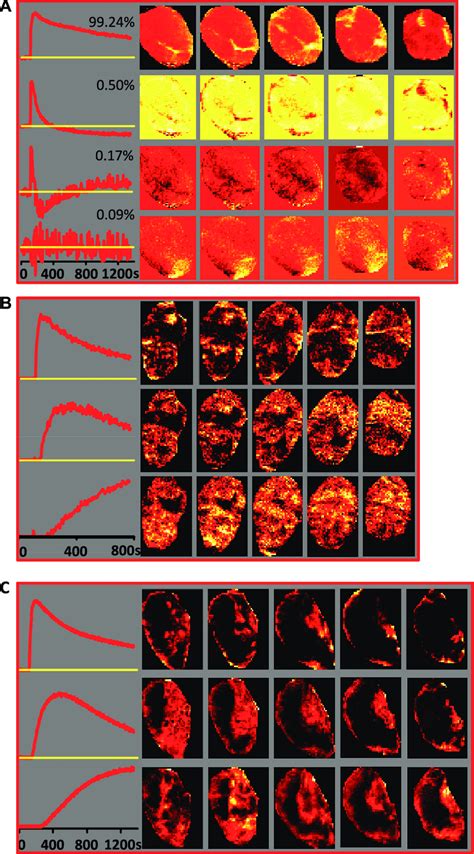 Pr Analysis A Left First Four Pcs From Dce Mri Data From The Download Scientific Diagram
