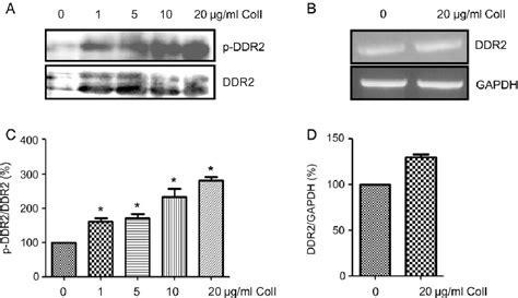 Table 1 From Ddr2 Inhibition Reduces Migration And Invasion Of Murine Metastatic Melanoma Cells