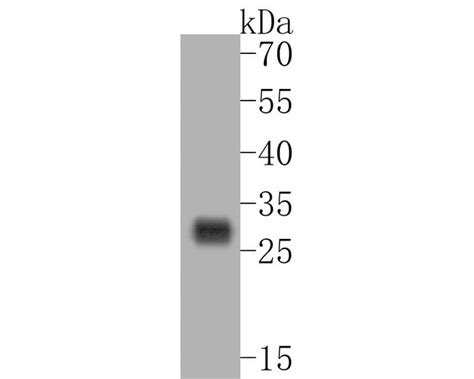 Hla Drb4 Recombinant Rabbit Monoclonal Antibody Je55 85 Invitrogen