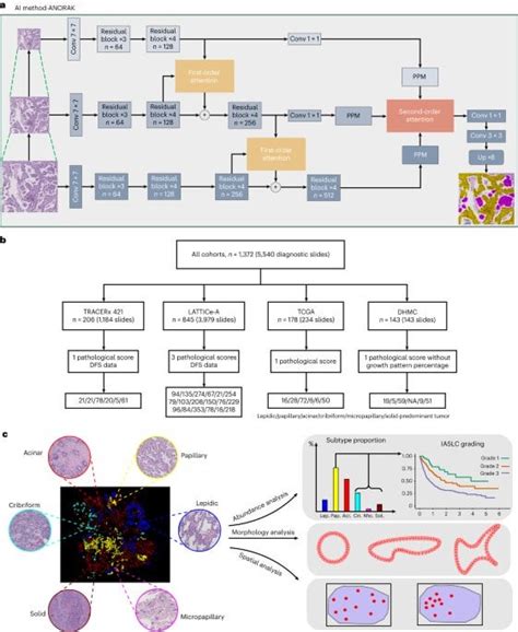 The Artificial Intelligence Based Model Anorak Improves Histopathological Grading Of Lung