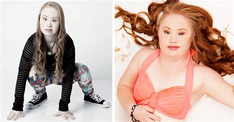 Teen With Down Syndrome Is Determined To Become A Model Bored Panda