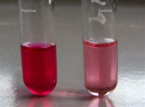 Fermentation Test Regnum Prokaryotae Software