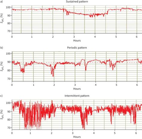 Overnight Oximetry Patterns A Sustained B Periodic And C Download Scientific Diagram