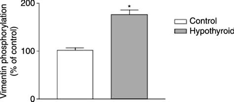 Effect Of Congenital Hypothyroidism On Vimentin Phosphorylation In