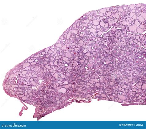 Thyroid Follicles Stock Image Image Of Cell Microscopic 93292489