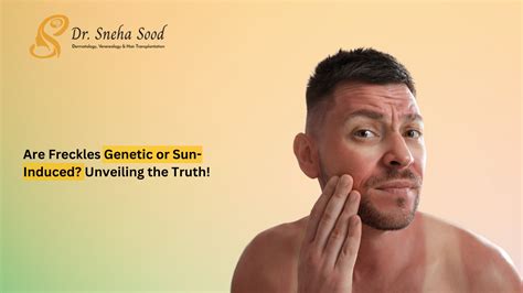Freckles Genetic Or Sun Induced Debunking The Myths
