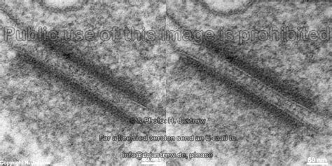 Spot Desmosome Dr Jastrows Electron Microscopic Atlas