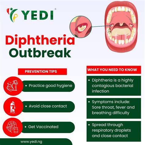 Yedi Naija Stay Safe Prevent Diphtheria Diphtheria Is A Serious
