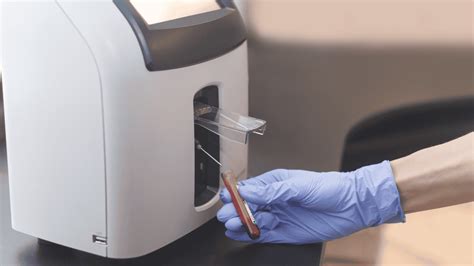 Electrolyte Testing In Diagnostics Why It Matters