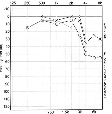 Costco Hearing Aids R Hearingaids