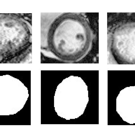 Segmentation Loss The Training And Validation Loss While Training One Download Scientific