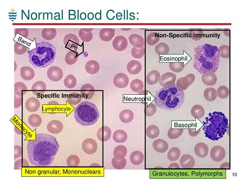 PPT Pathology Of WBC Disorders PowerPoint Presentation Free Download ID 8201916