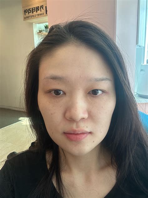 의사에게 물어보세요 내 눈의 가장 높은 강남언니 1등 성형수술and피부시술 정보앱