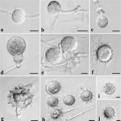 Pythium Nodosum CUU 46 Ab An Antheridium Attached To Each Download Scientific Diagram