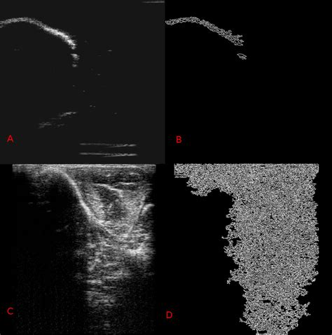 result of canny edge detection algorithm for ultrasound scan of sawbone download scientific
