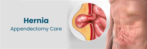 Hernia And Appendectomy Care In Karimnagar