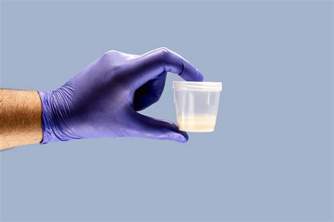 Semen Cryopreservation Pfrcivf