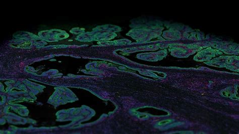 Novogene Presents Advanced Sequencing Services Featuring Nanostrings