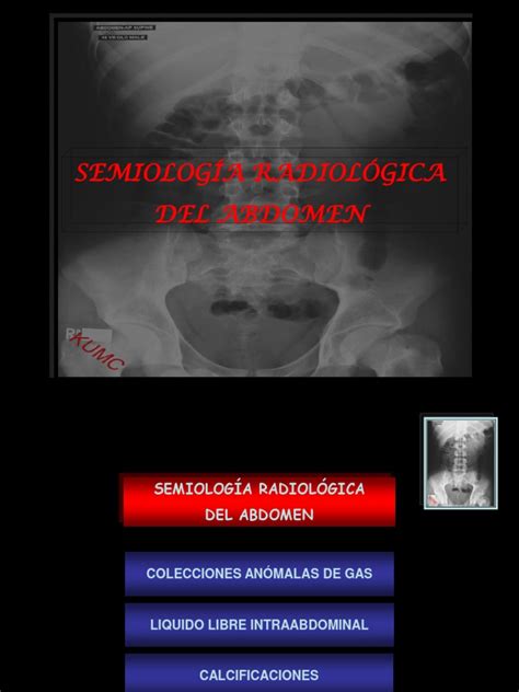 Semiotécnicas Radiológicas Abdominales Pdf