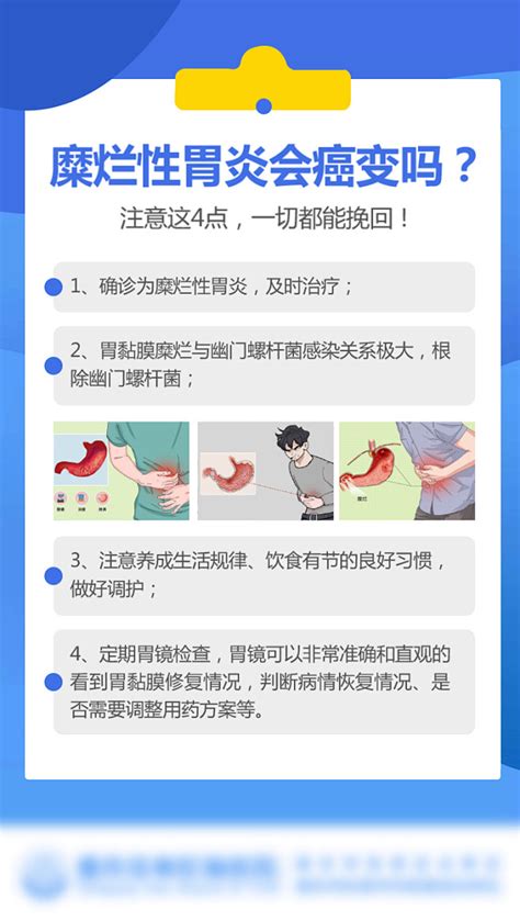 医疗糜烂性胃炎科普海报