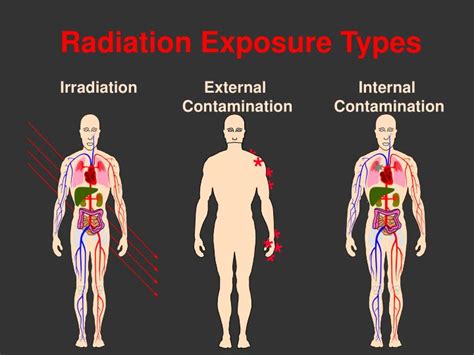 Ionizing Radiation Exposure Radiation Exposure Nuclear
