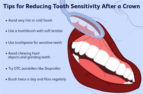 Tooth Sensitivity After Crown Causes Symptoms Remedies