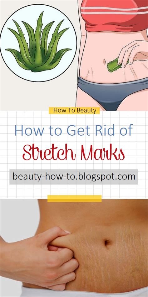 Get Rid Of Stretch Marks Noredfab