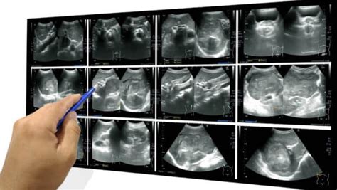 Echogenic Pancreas Ultrasound All You Need To Know Myconciergemd