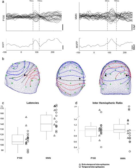 the mismatch negativity mmn potential as a tool for the functional