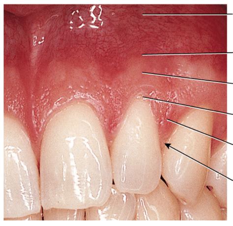 The Gingiva Diagram Quizlet
