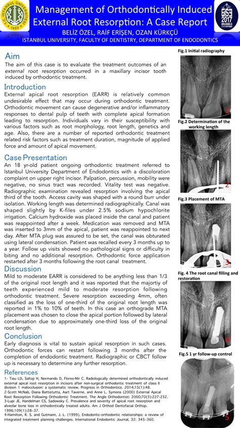 Pdf Management Of Orthodontically Induced External Root Resorption A Case Report