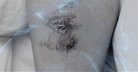 Dreaming Of An Incurable Wound 10 Spiritual Meaning