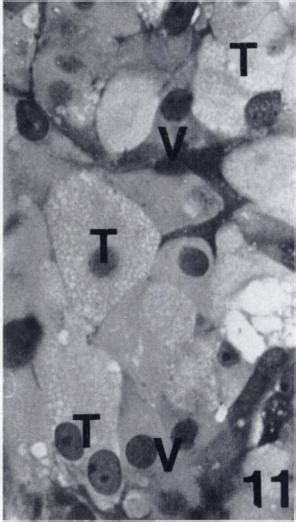 Enlarged Micrograph Of A Group Of Thyrotrophs 1 To Show The