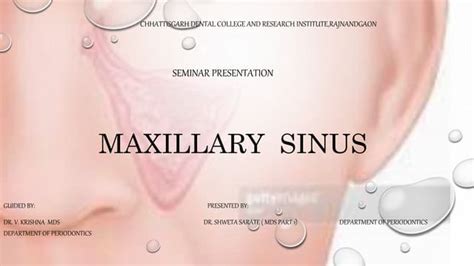 Maxillary Sinus Pptx